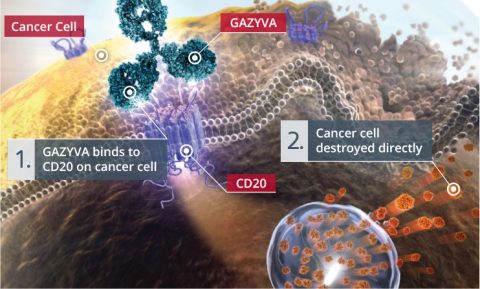 How GAZYVA® (obinutuzumab) is Thought to Work in First-Line CLL
